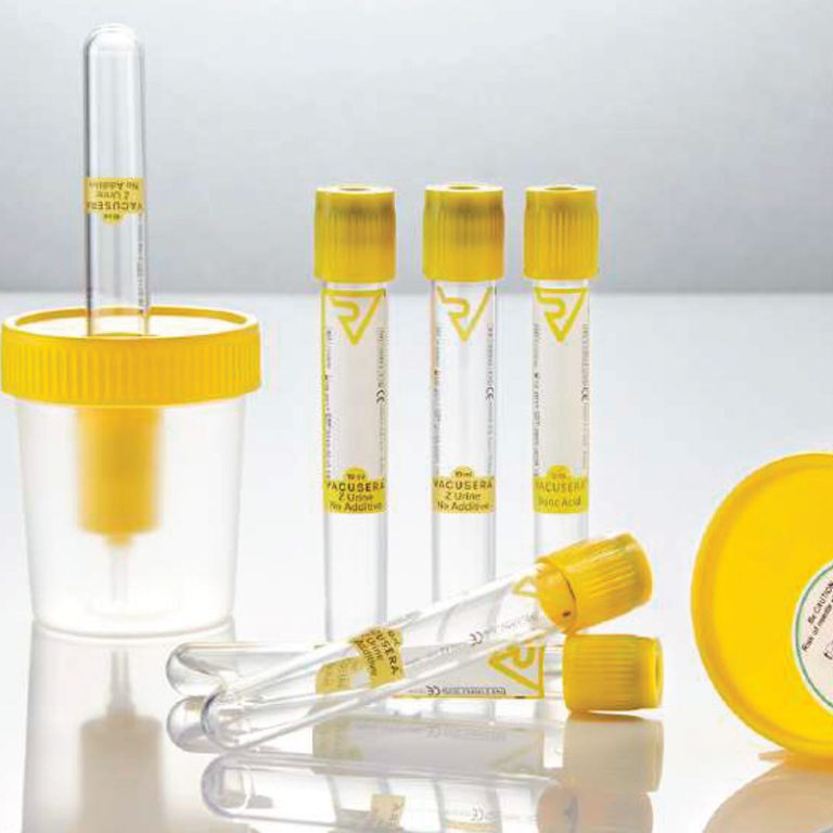 Sistema di Prelievo Urine - Preanalitica